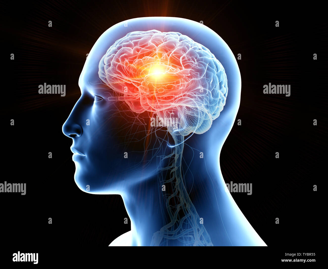 3d rendered medically accurate illustration of human brain cancer Stock ...