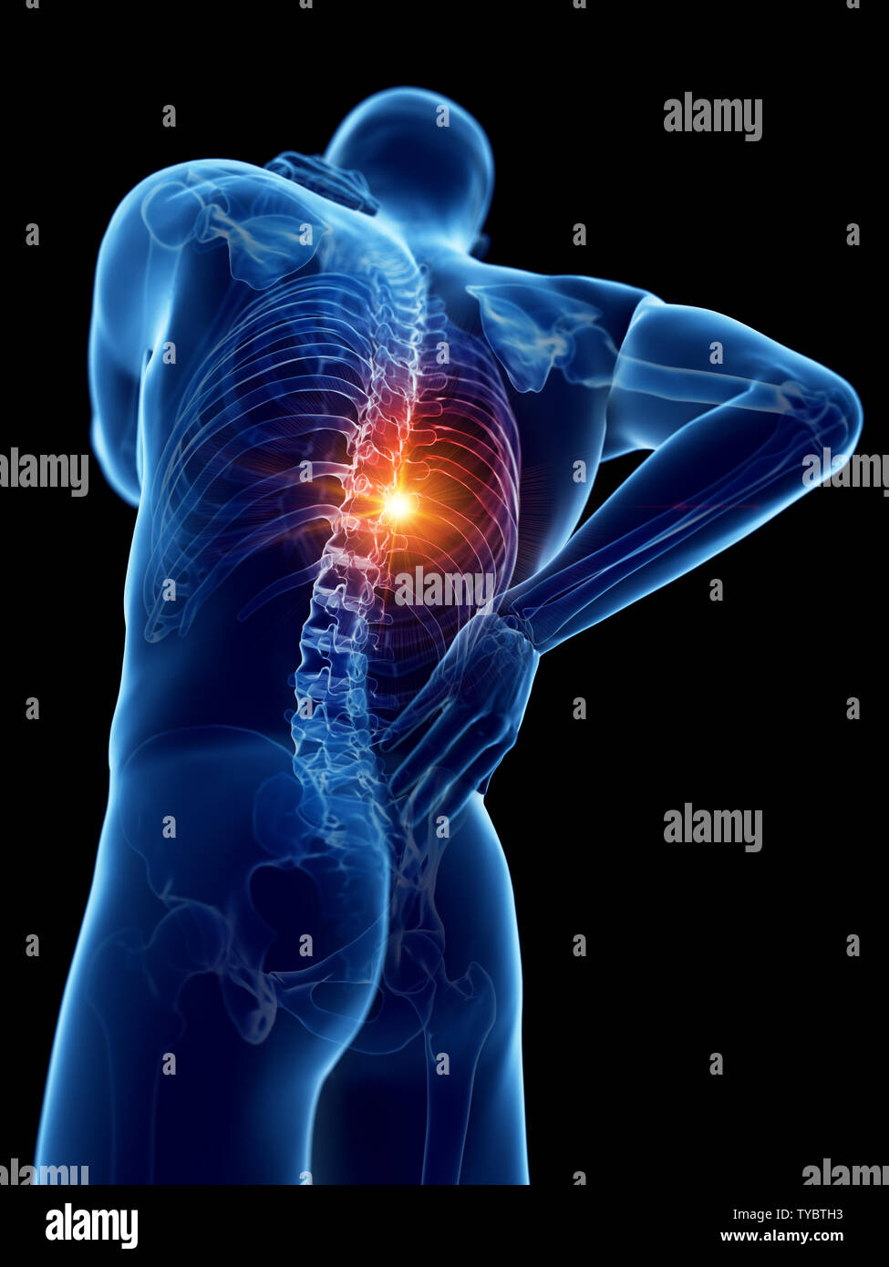 3d rendered medically accurate illustration of a man having a painful ...