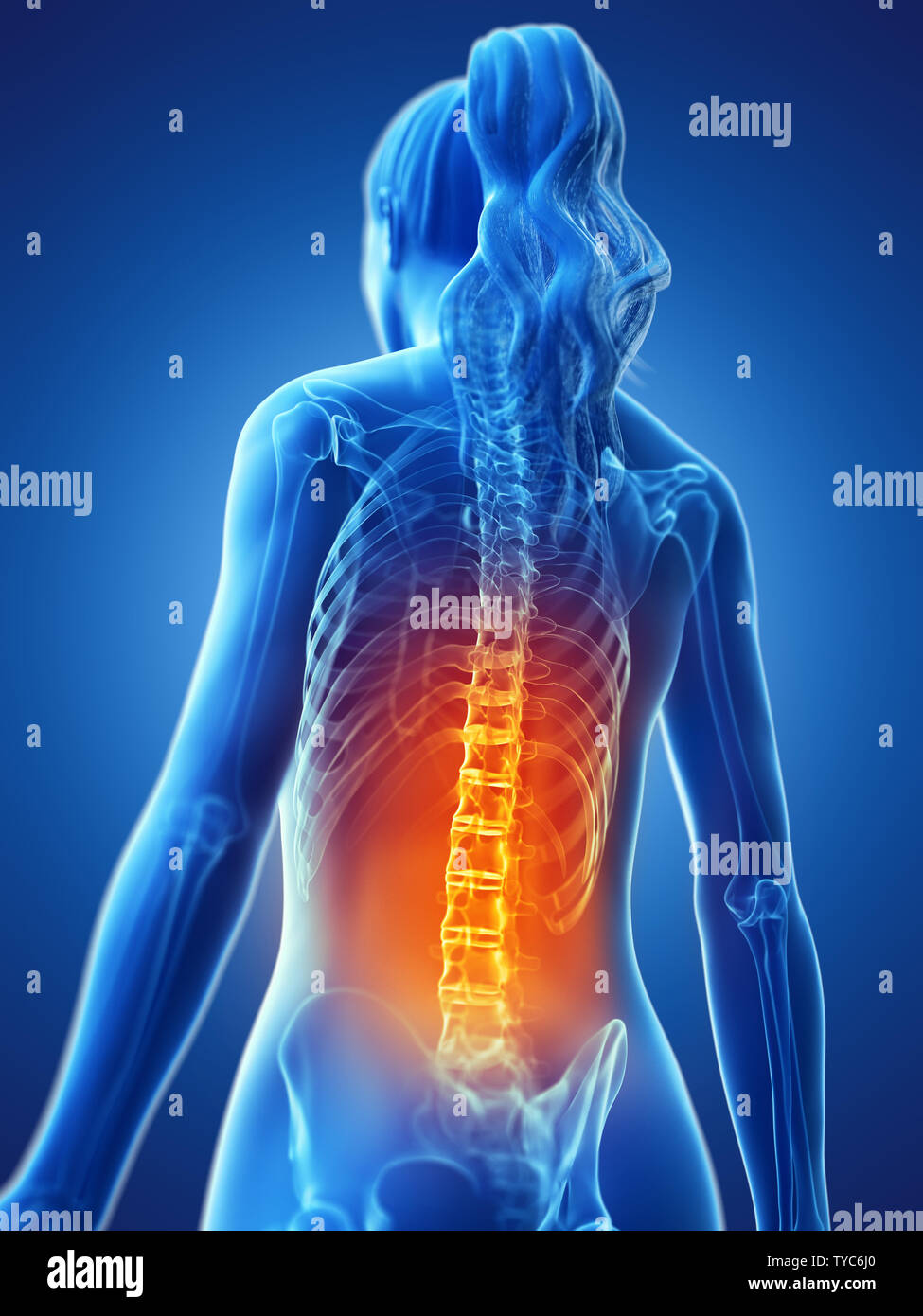 3d rendered medically accurate illustration of a woman having a painful ...