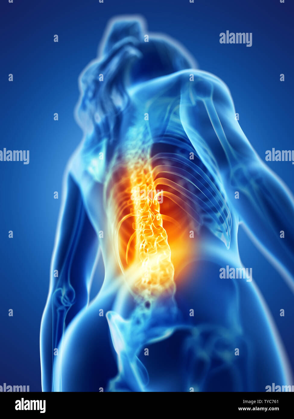 Back pain woman graphic hi-res stock photography and images - Alamy