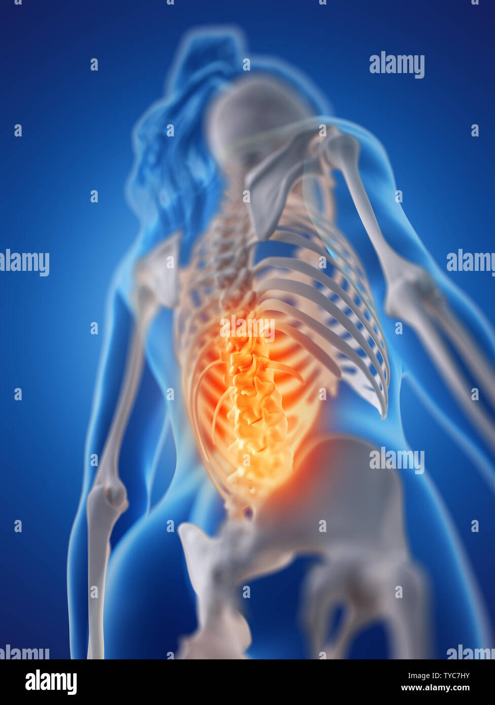 Back pain woman graphic hi-res stock photography and images - Alamy