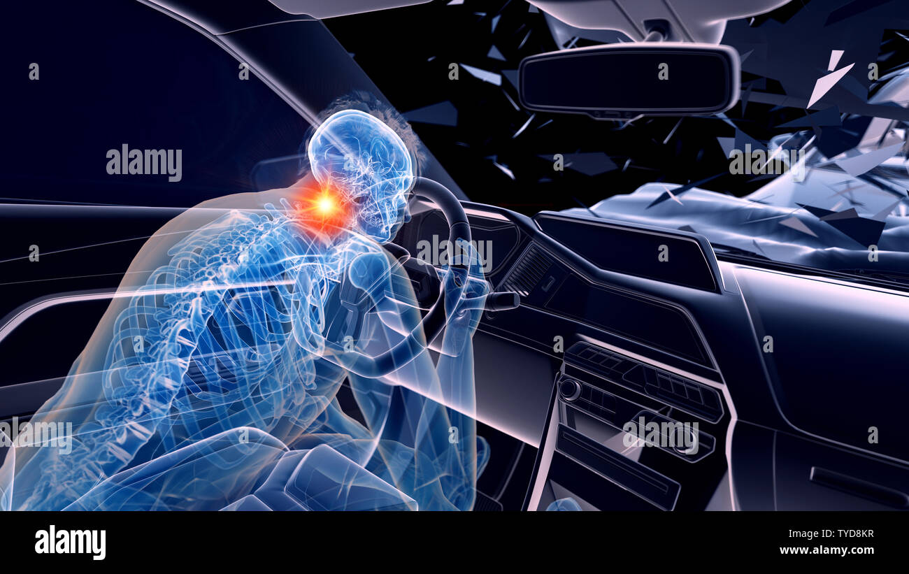 Frontal impact injury hi-res stock photography and images - Alamy