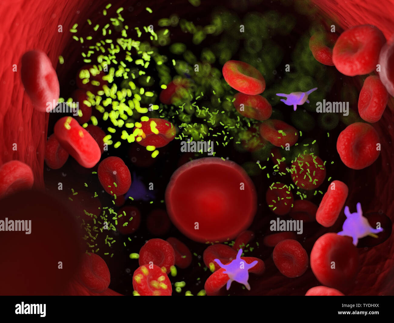 3d rendered medically accurate illustration of bacterias in an artery ...