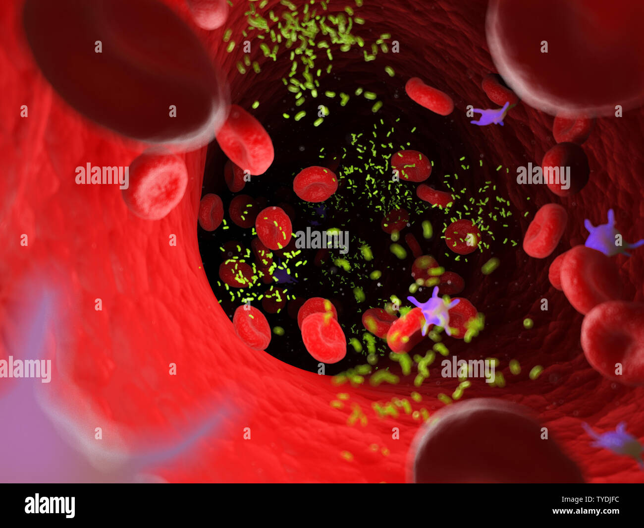 3d rendered medically accurate illustration of bacterias in an artery ...