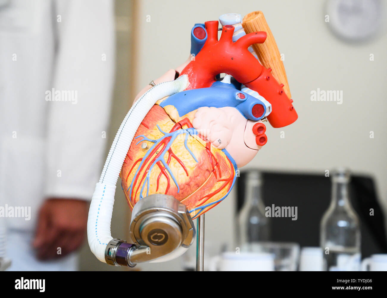 Heartmate hi-res stock photography and images - Alamy