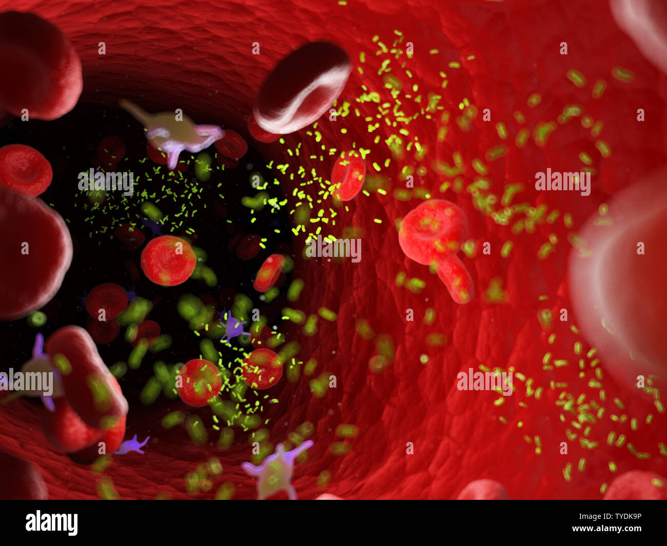 3d rendered medically accurate illustration of bacterias in an artery ...