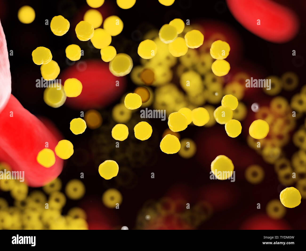 Fat in the blood hi-res stock photography and images - Alamy