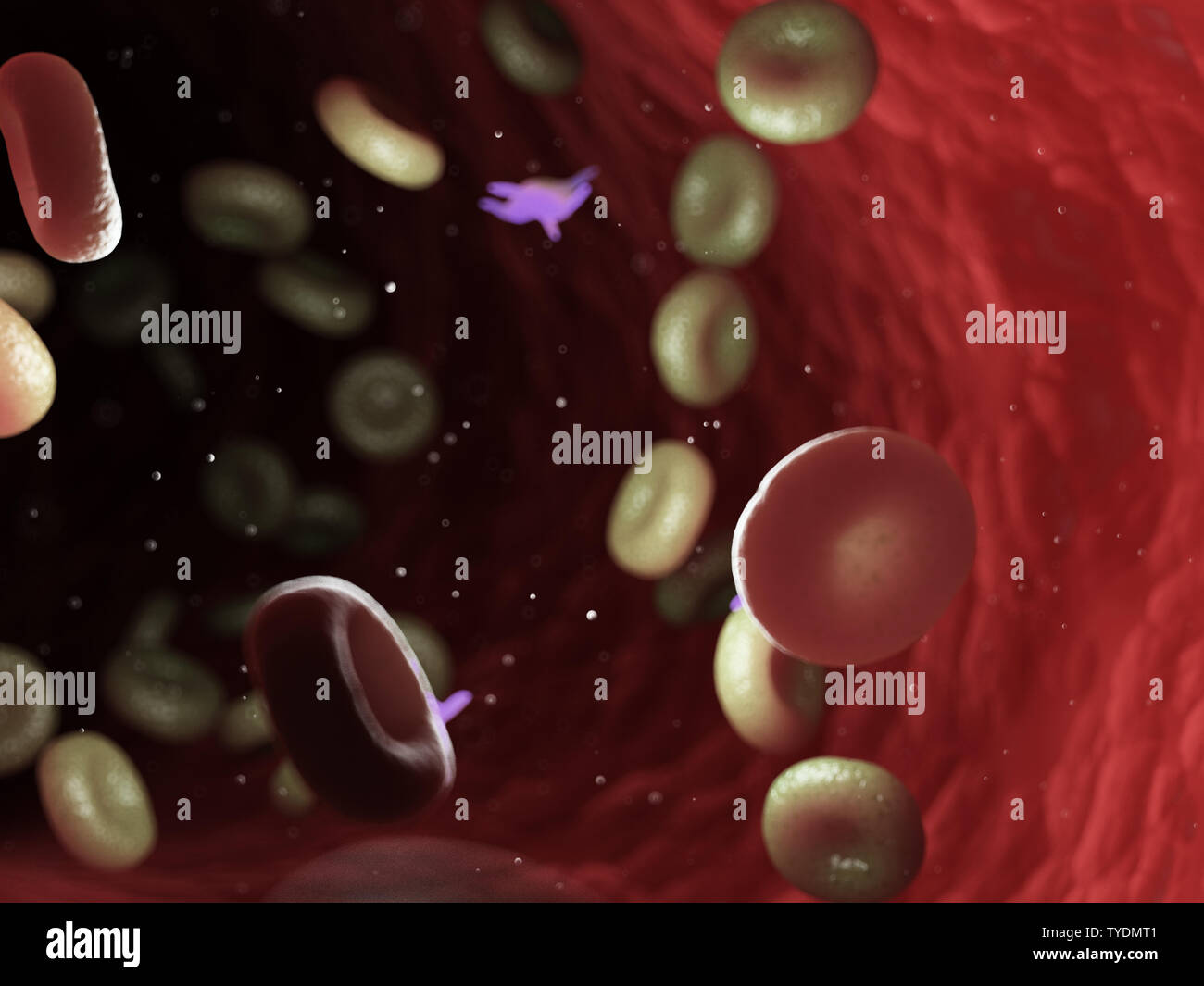 3d rendered medically accurate illustration of diseased blood cells ...