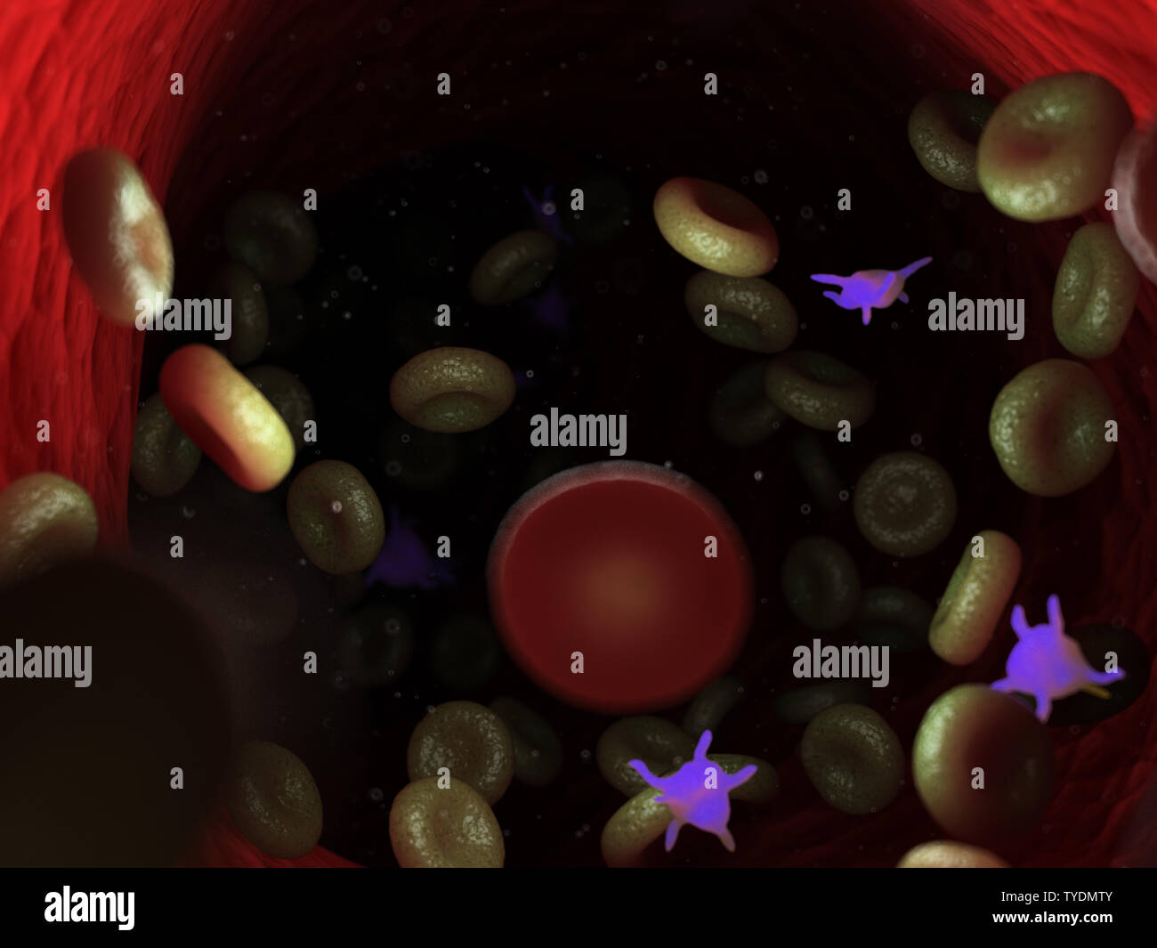 3d rendered medically accurate illustration of diseased blood cells ...