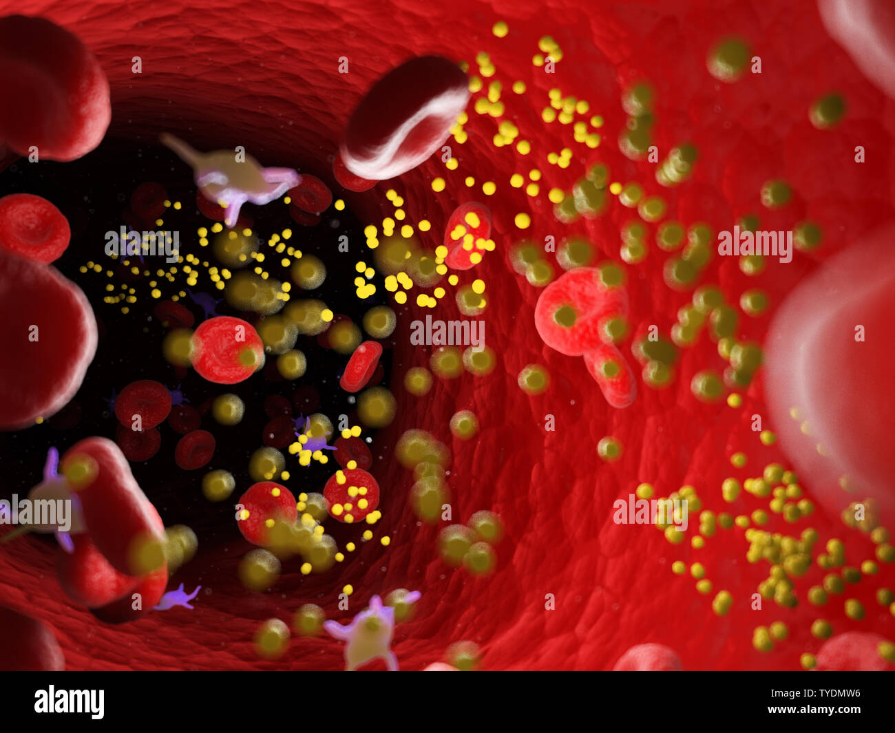 3d rendered medically accurate illustration of fat in the blood flow ...