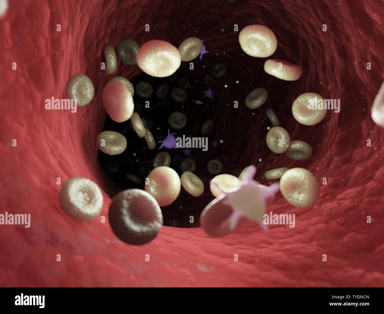 3d rendered medically accurate illustration of diseased blood cells ...