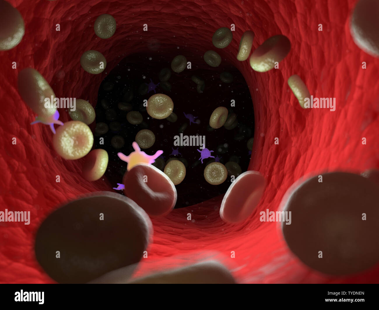 3d rendered medically accurate illustration of diseased blood cells ...