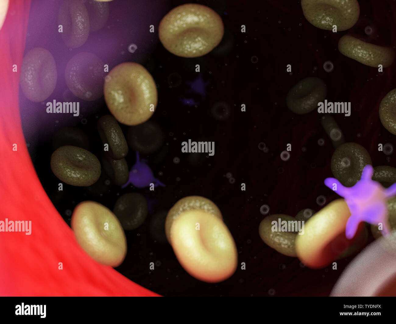 3d rendered medically accurate illustration of diseased blood cells ...