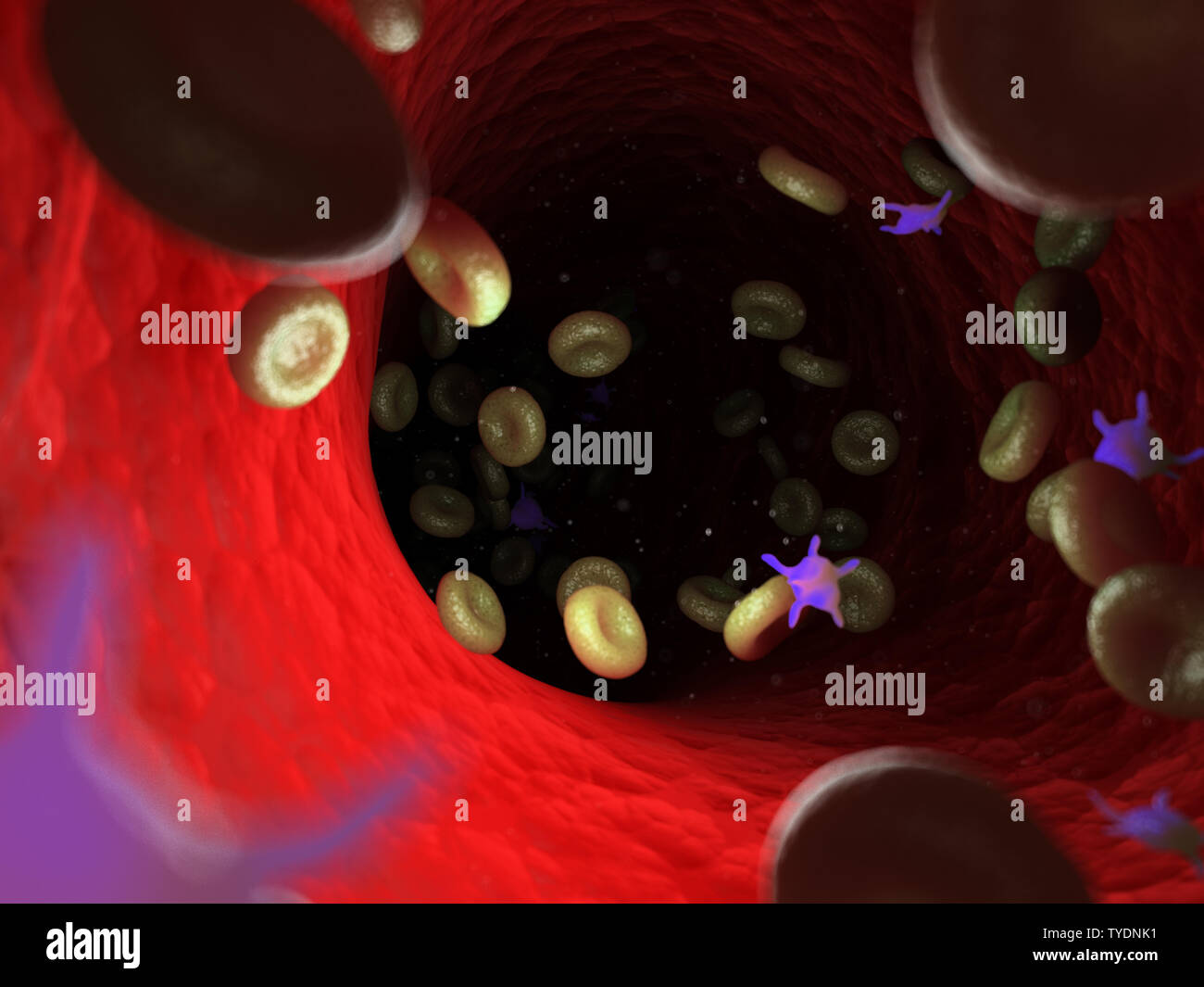 3d rendered medically accurate illustration of diseased blood cells ...