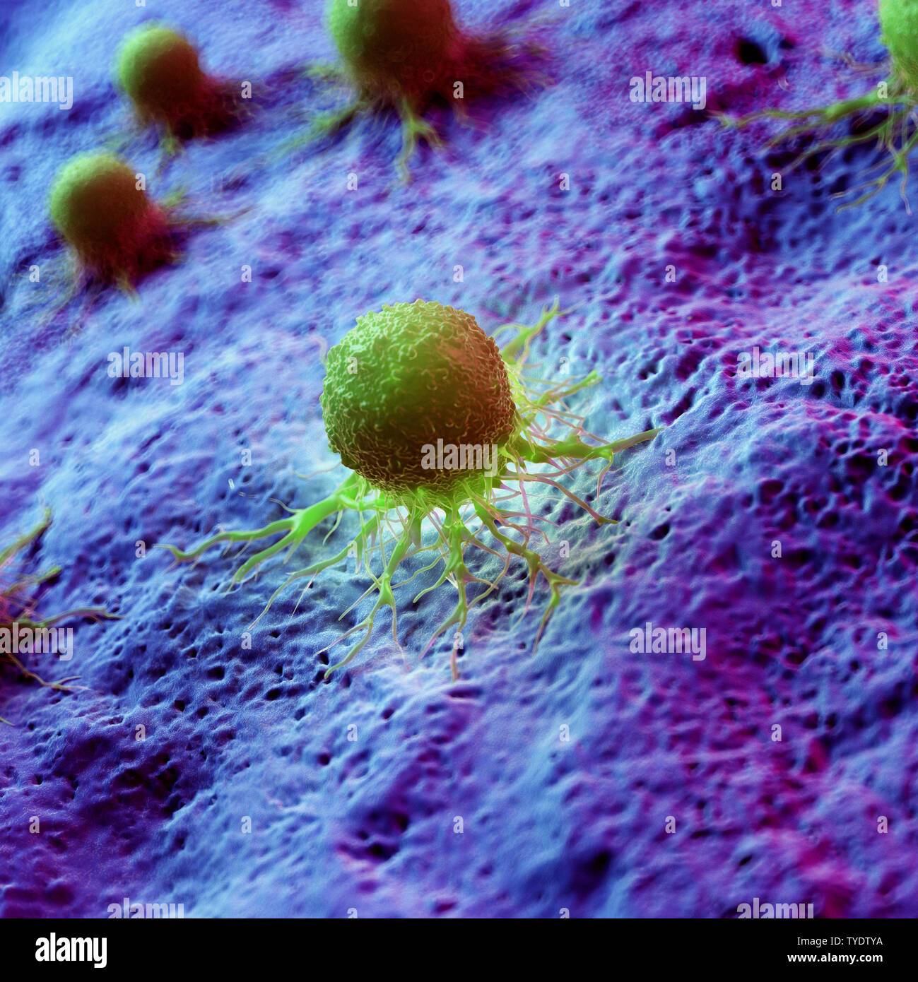 Cancerous cells hi-res stock photography and images - Alamy