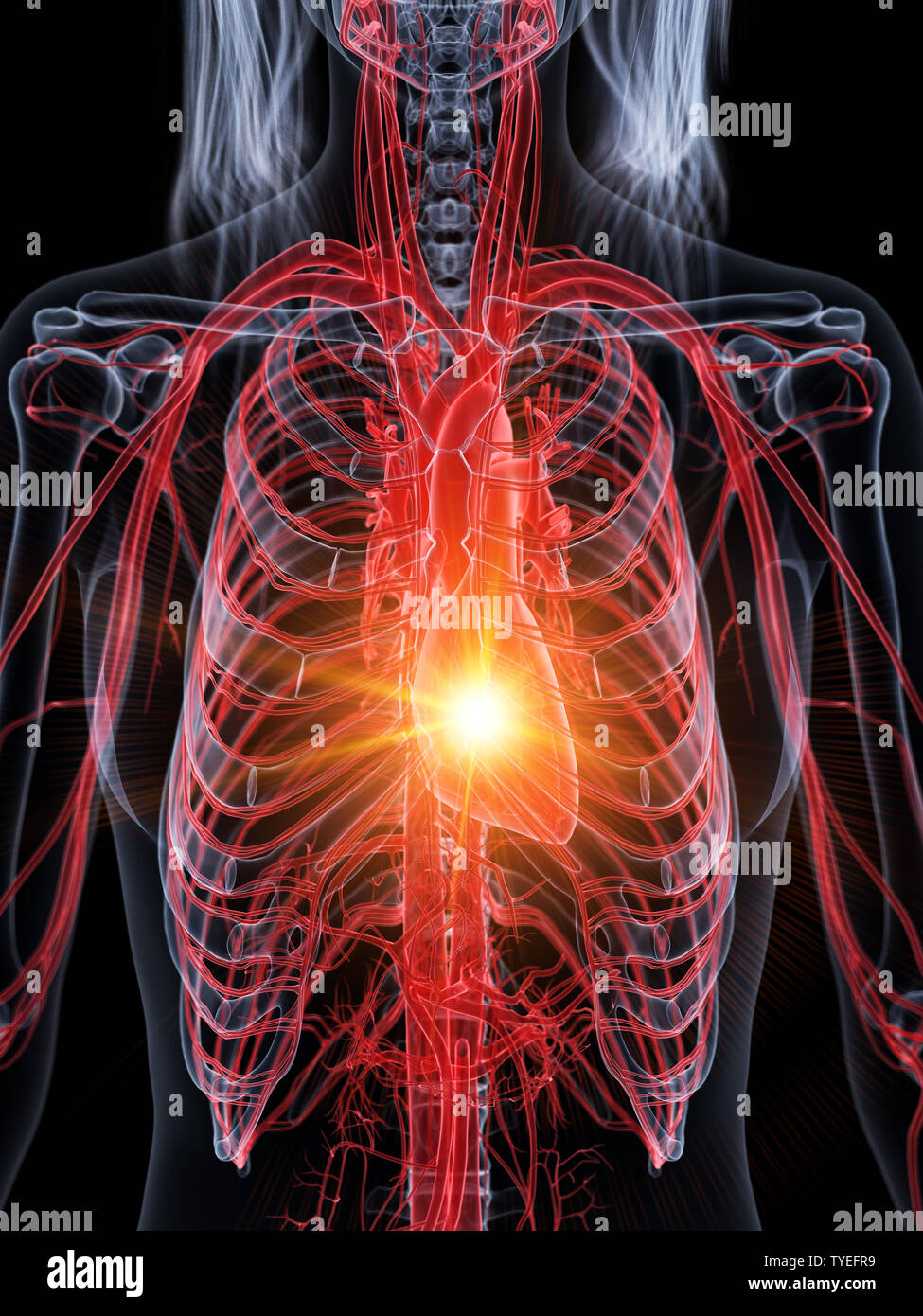 Woman heart attack illustration hi-res stock photography and images - Alamy