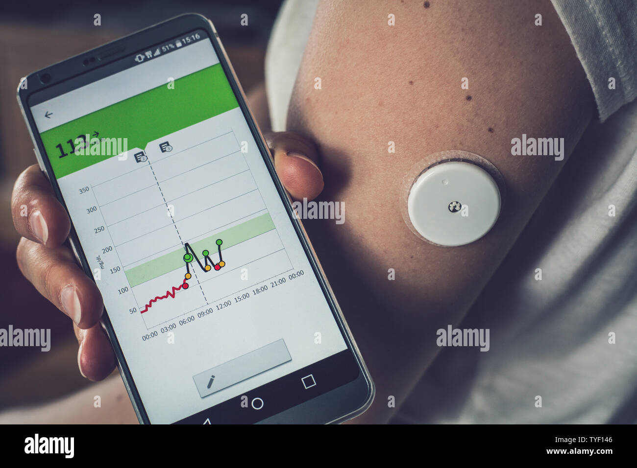 Woman checking glucose level with remote new technology sensor and ...