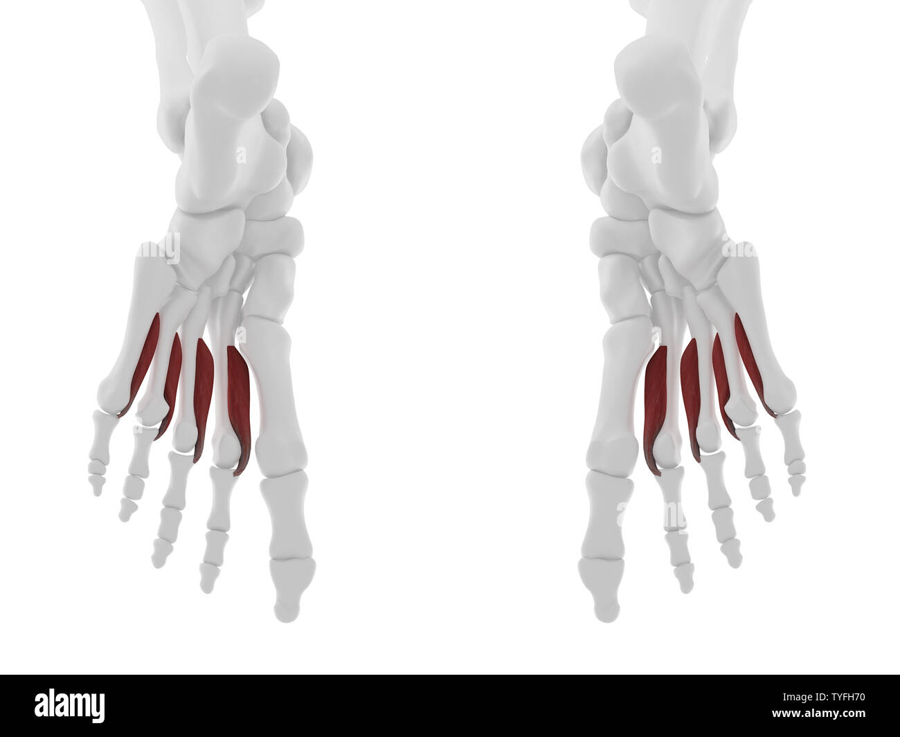Plantar Interossei Pain