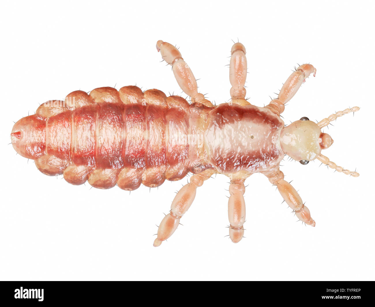Head lice bite Cut Out Stock Images & Pictures - Alamy