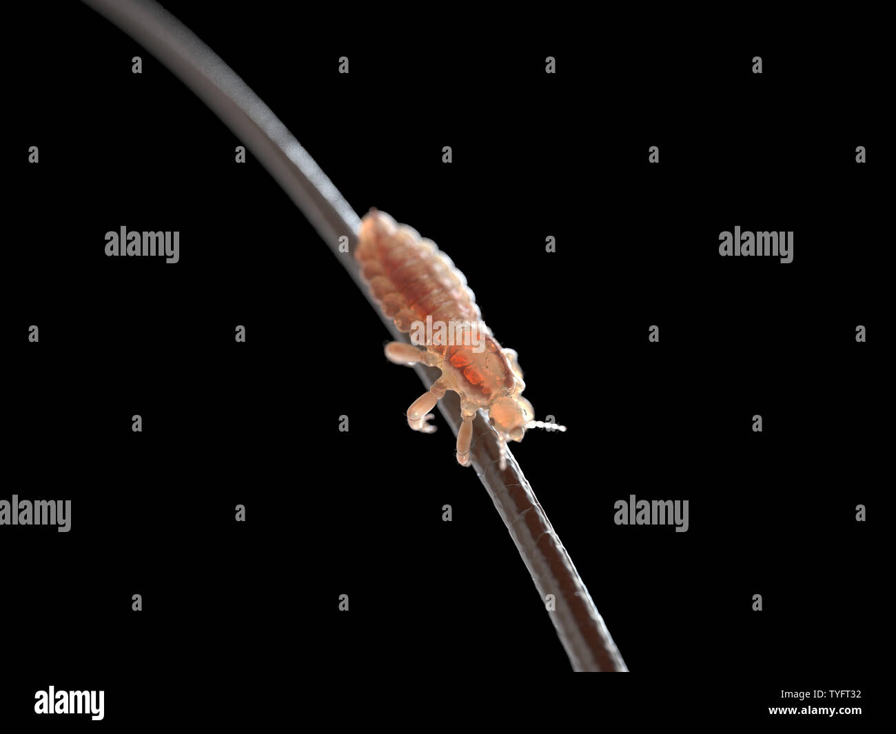 Human head louse hi-res stock photography and images - Alamy
