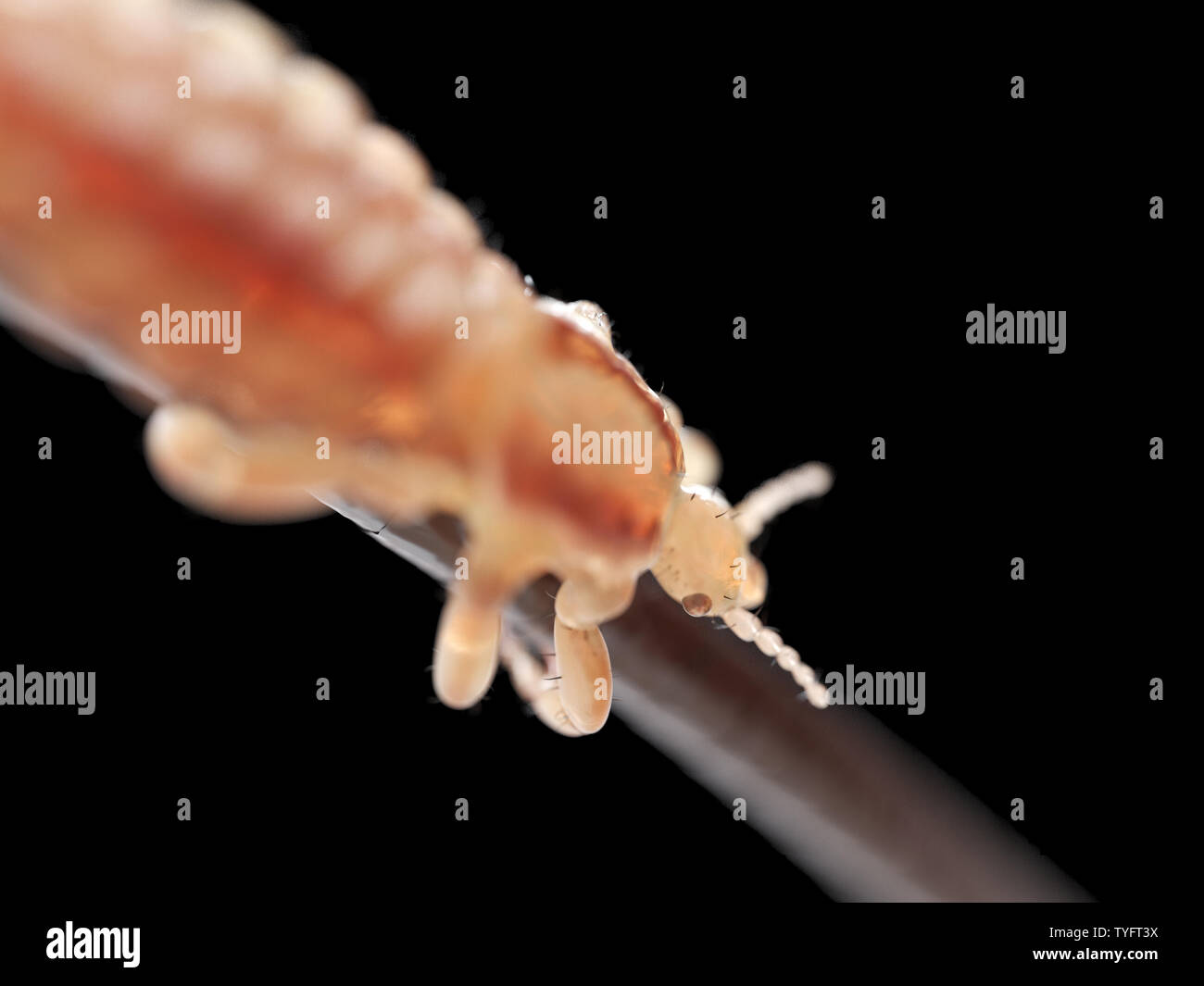 Head lice nymphs hi-res stock photography and images - Alamy