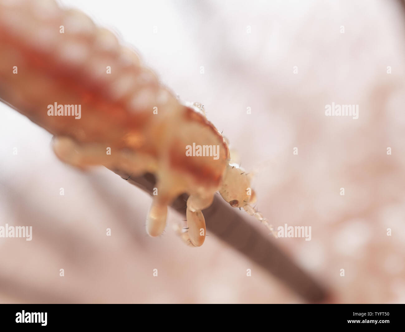 3d rendered illustration of a head louse Stock Photo - Alamy