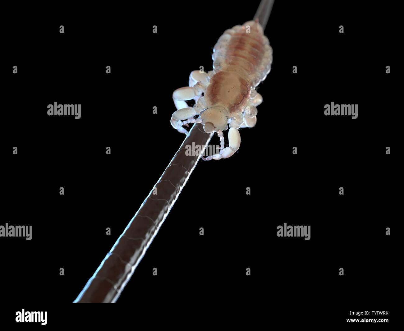 3d rendered illustration of a head louse Stock Photo - Alamy