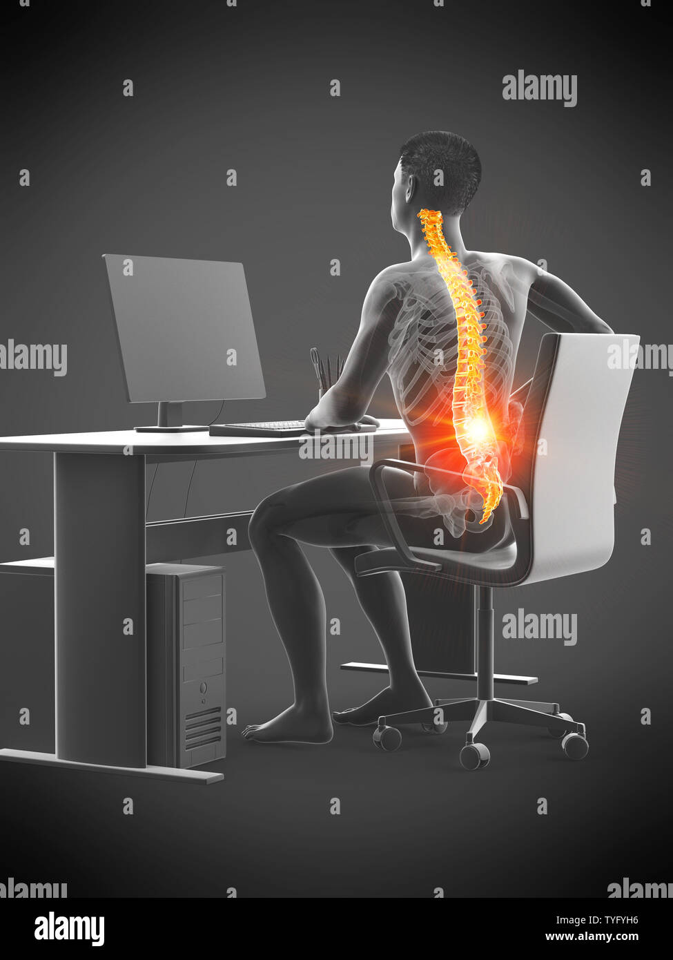 Workers back pain hi-res stock photography and images - Alamy