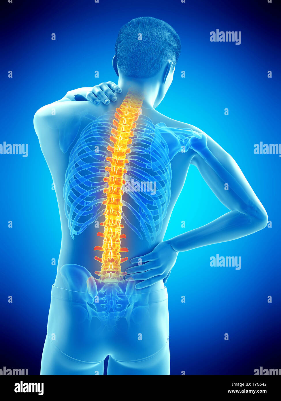 3d rendered medically accurate illustration of a mans painful back ...