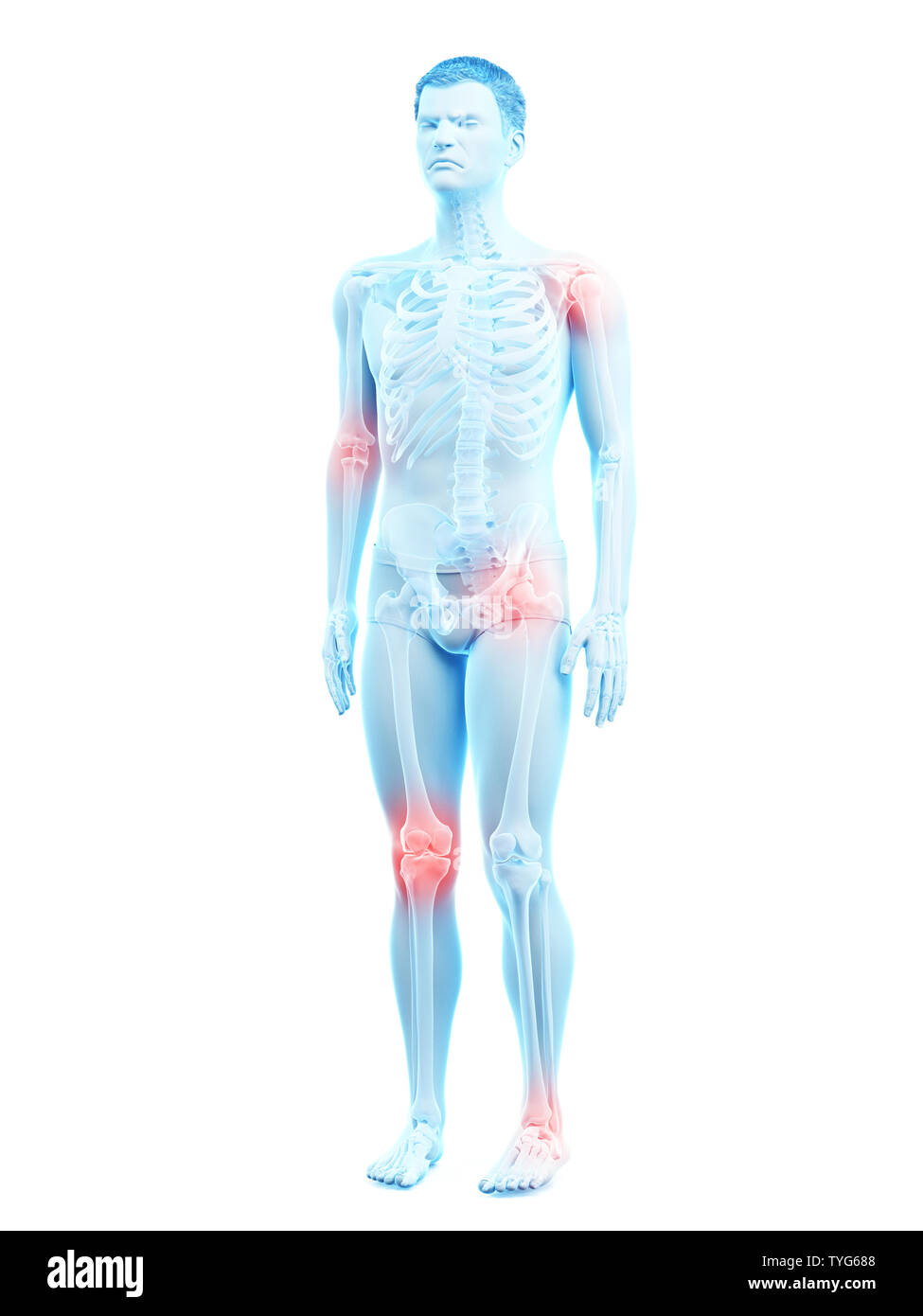 Painful wrist Cut Out Stock Images & Pictures - Alamy