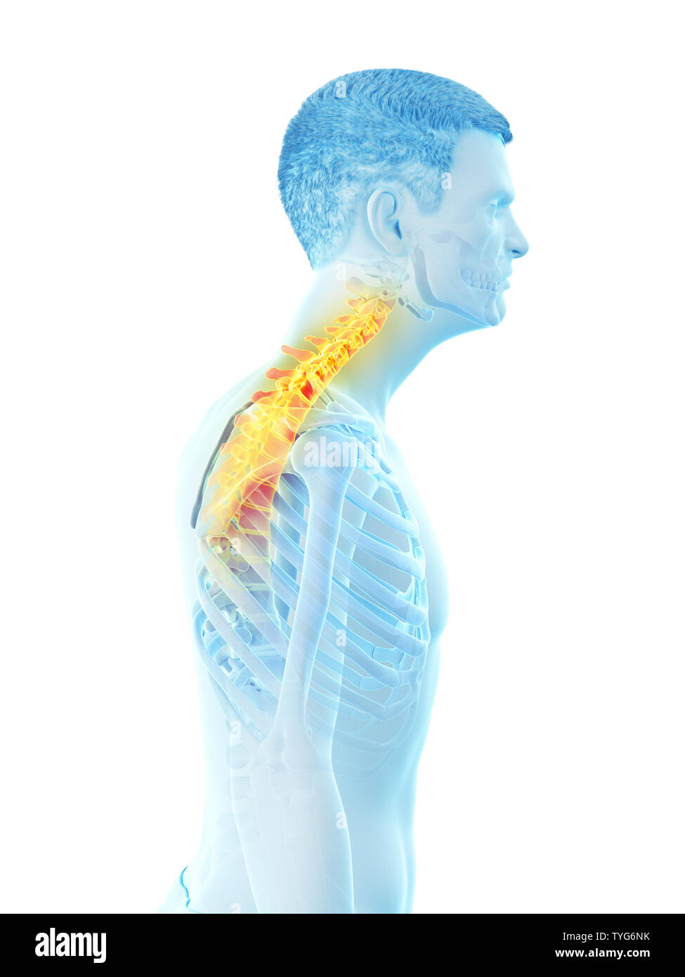 3d rendered medically accurate illustration of a mans painful neck ...