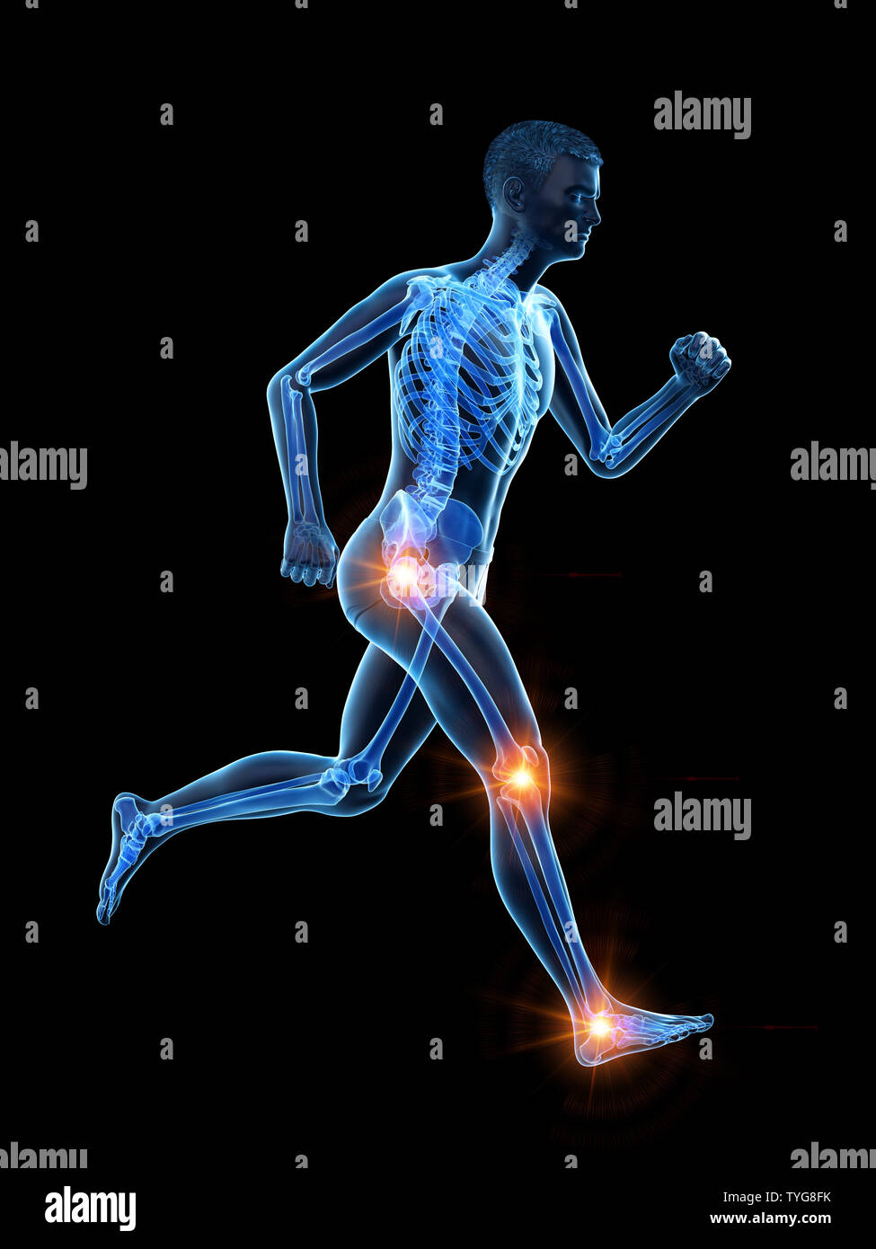3d rendered medically accurate illustration of a runners painful joints ...