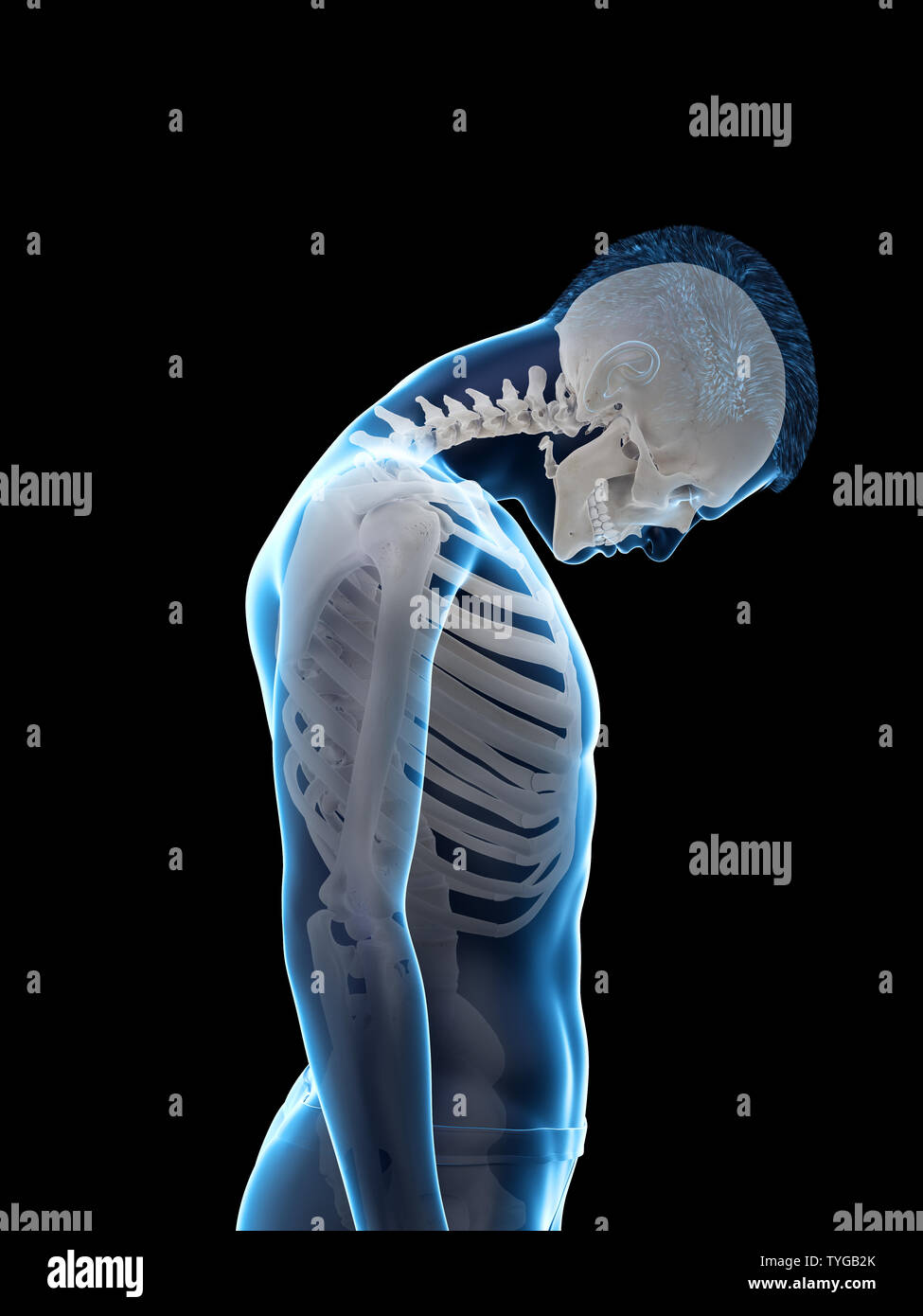 3d rendered medically accurate illustration of a mans neck Stock Photo ...