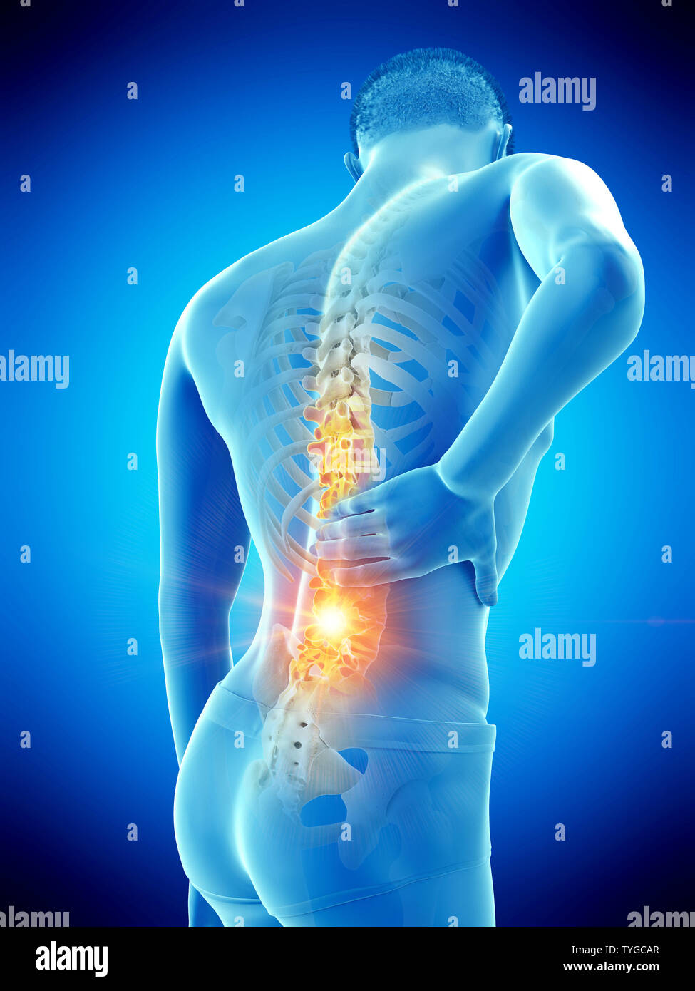 3d rendered medically accurate illustration of a mans painful back ...