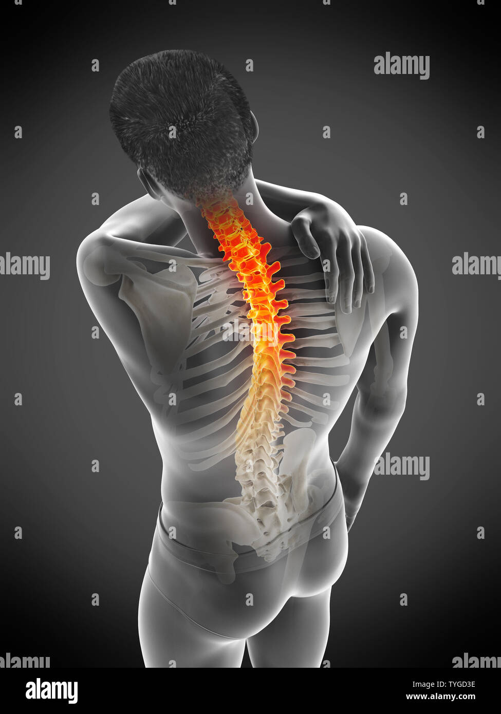 3d rendered medically accurate illustration of a man having a backache ...