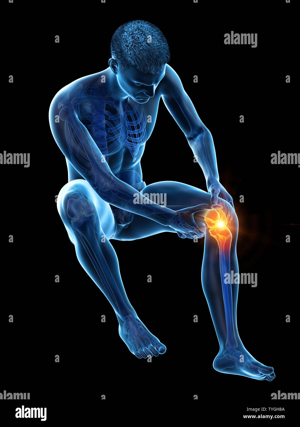 Painful knee artwork hi-res stock photography and images - Alamy