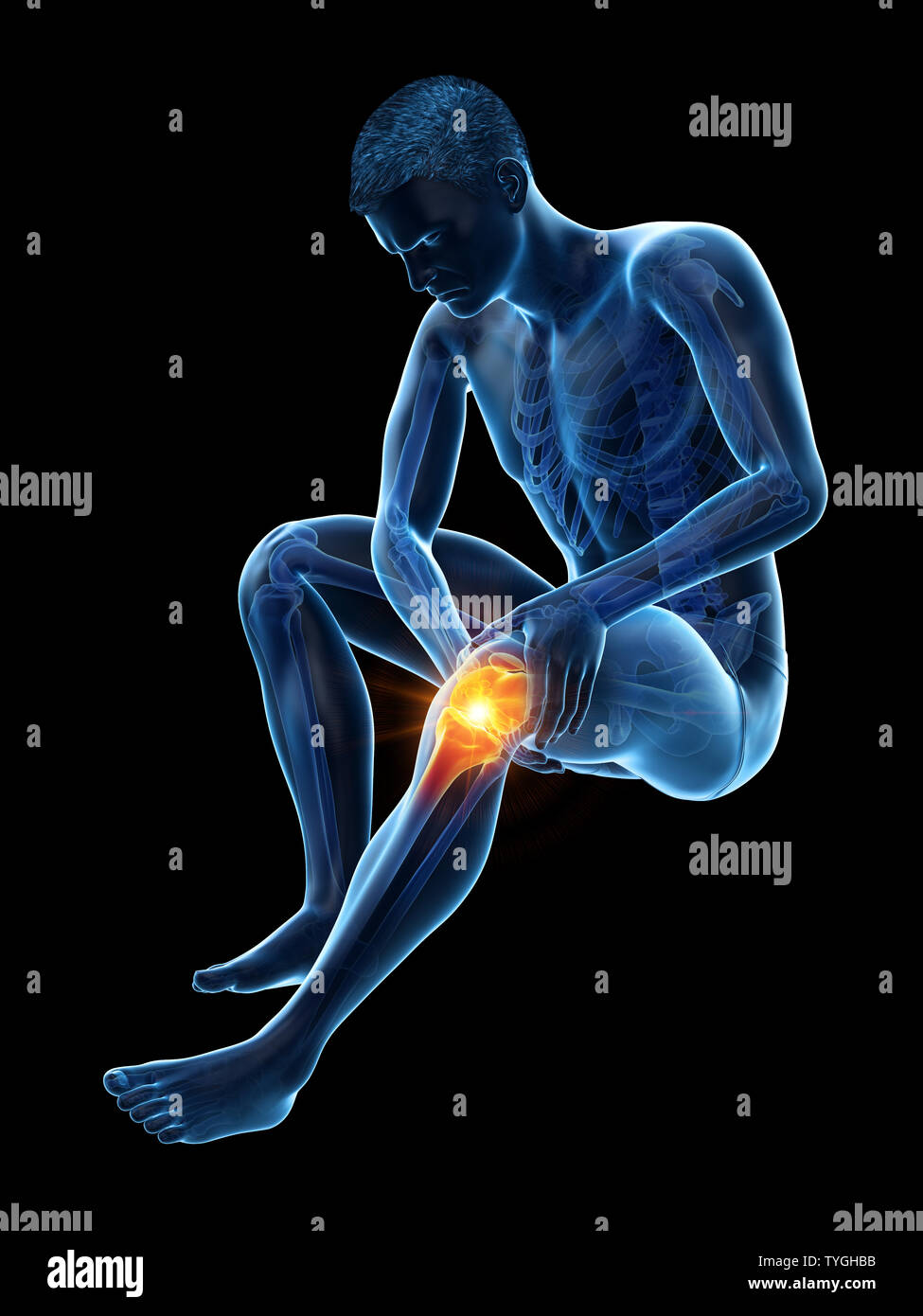 3d rendered medically accurate illustration of a man having a painful ...