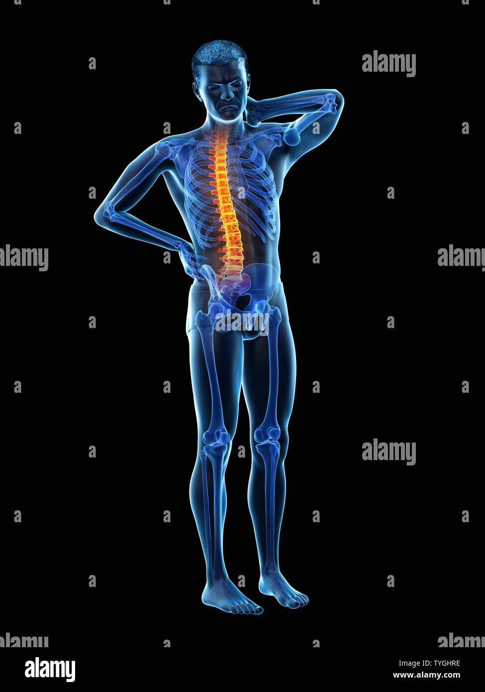 3d rendered medically accurate illustration of a man having a backache ...