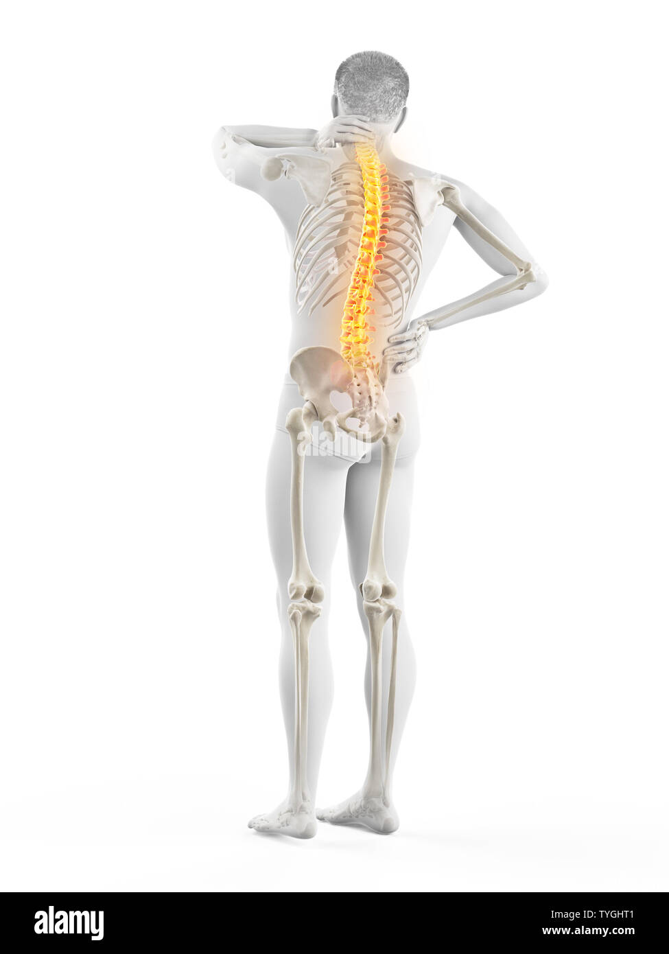 3d rendered medically accurate illustration of a man having a backache ...