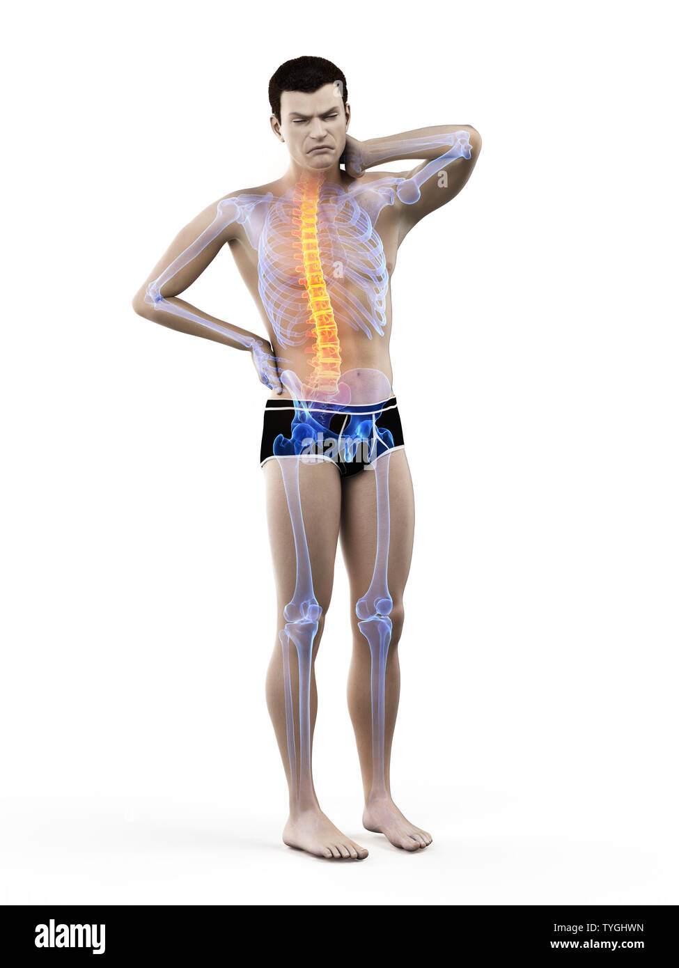 3d rendered medically accurate illustration of a man having a backache ...
