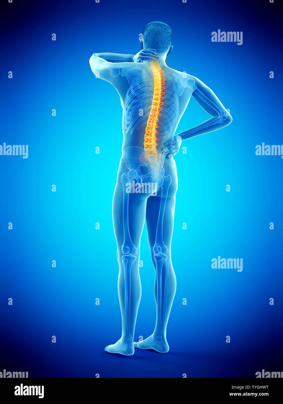 3d rendered medically accurate illustration of a man having a backache ...