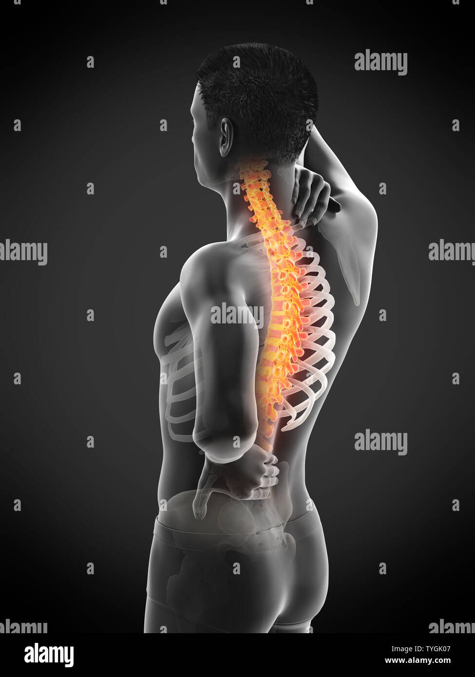 3d rendered medically accurate illustration of a man having a backache ...