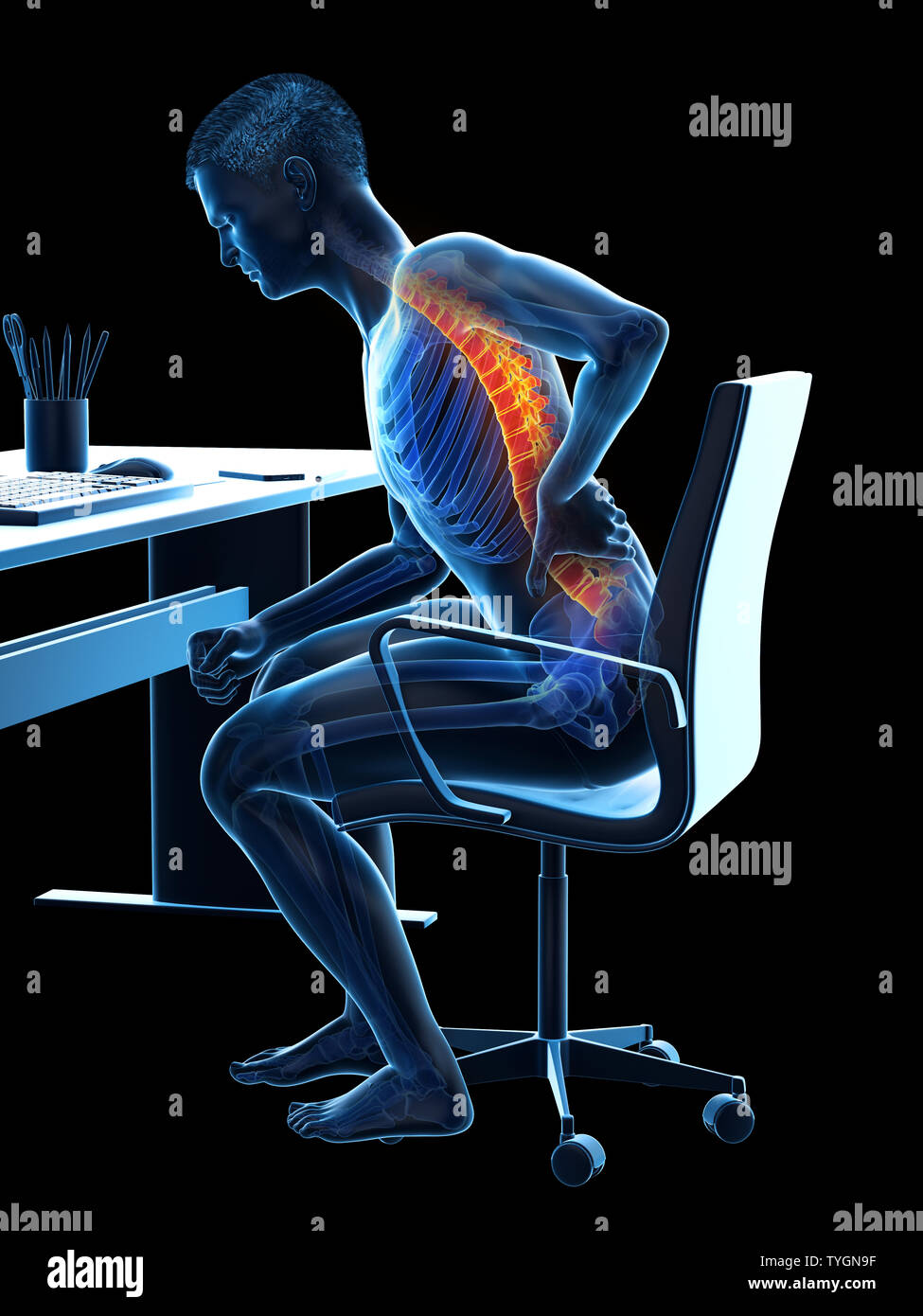 3d rendered medically accurate illustration of a man having a backache ...
