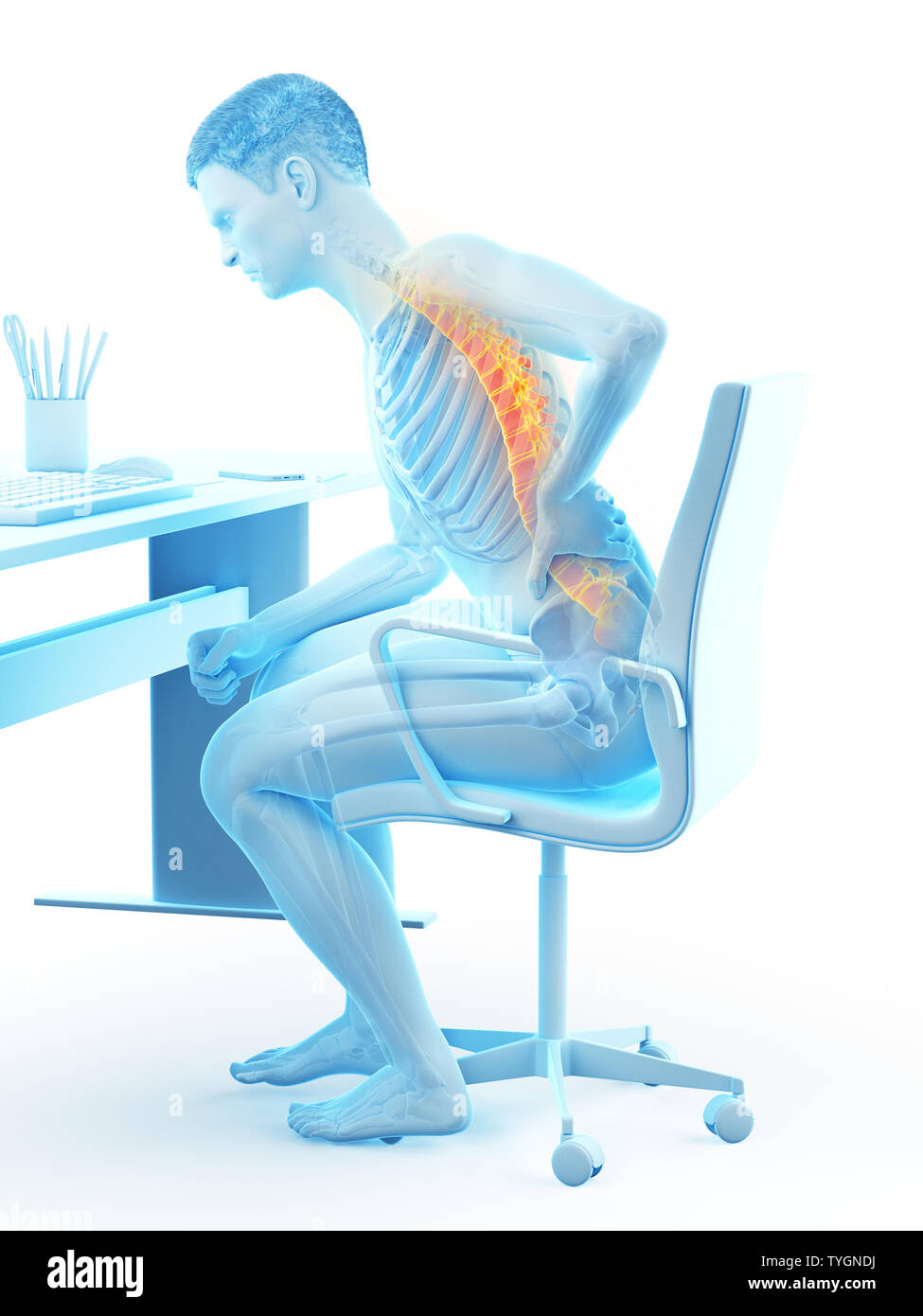 3d rendered medically accurate illustration of a man having a backache ...