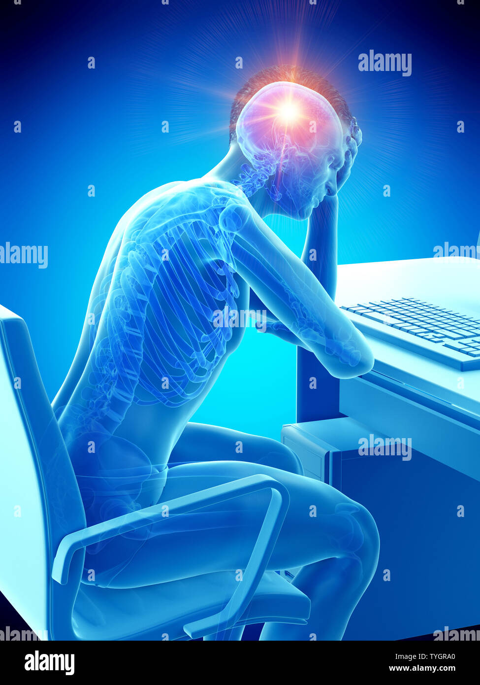 3d rendered medically accurate illustration of a man having a headache ...