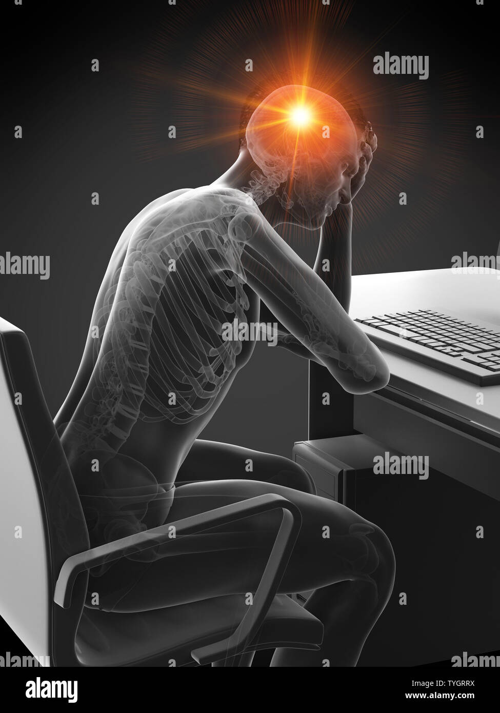 3d rendered medically accurate illustration of a man having a headache ...