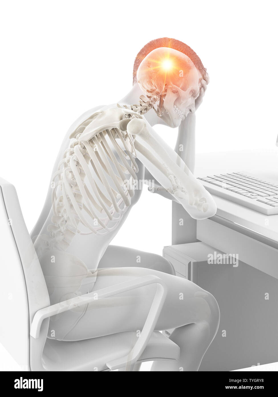 3d rendered medically accurate illustration of a man having a headache ...