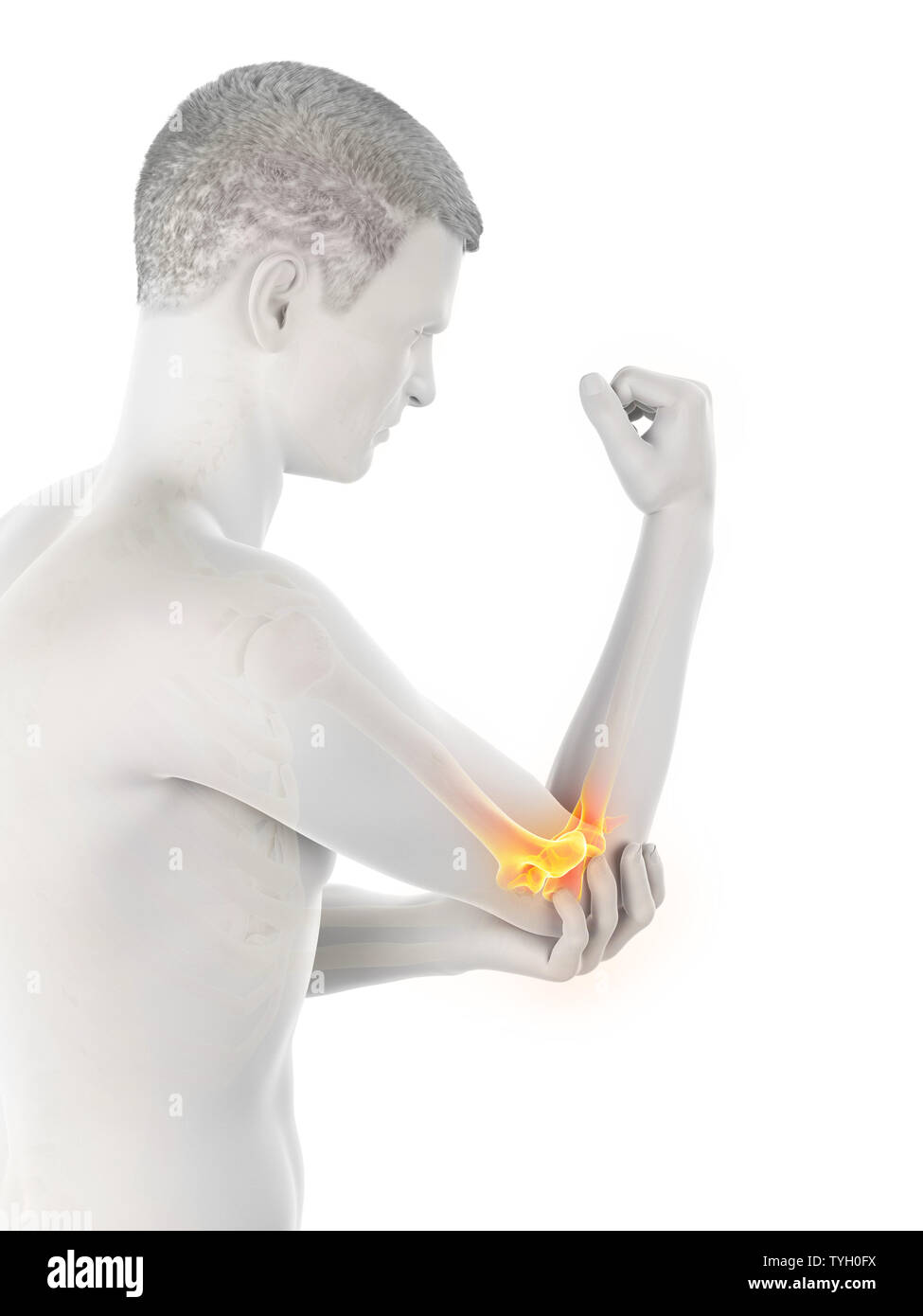 3d rendered medically accurate illustration of a man with painful elbow ...