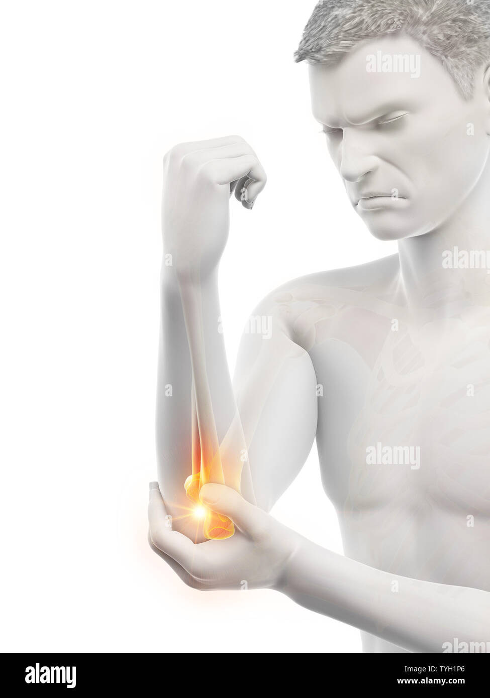 3d rendered medically accurate illustration of a man with painful elbow ...