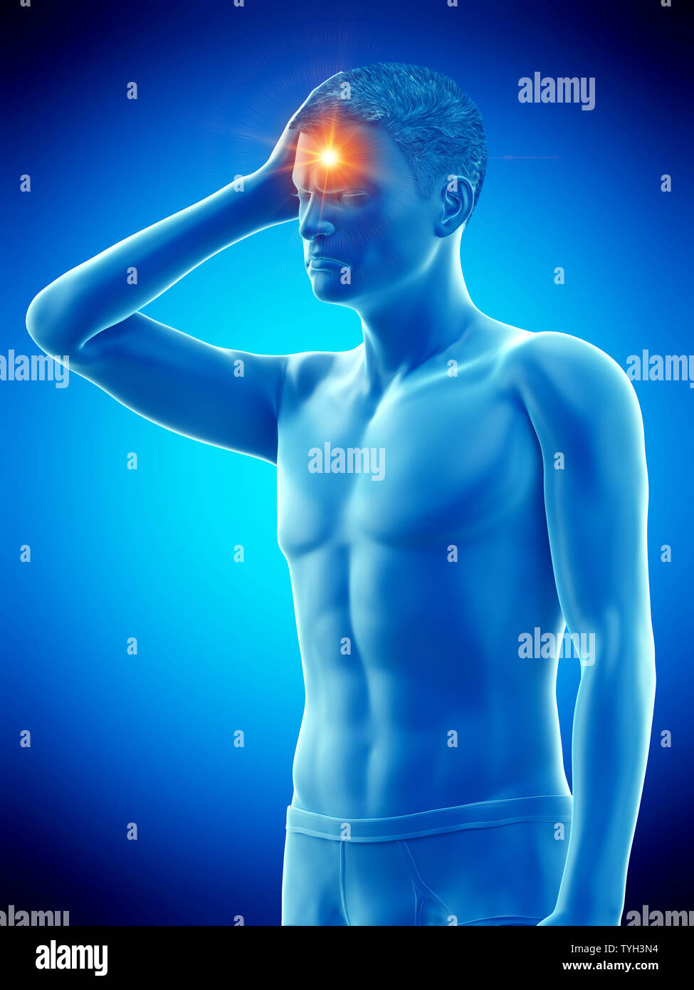 3d rendered medically accurate illustration of a man having headache ...